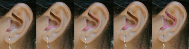 What to Do When Your Hearing Aid Keeps Falling Out ...