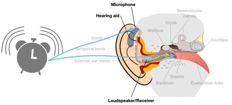 Troubleshooting Hearing Aids – What to Do When They Do Not Work ...