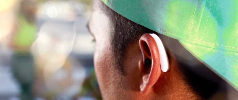 Signia Hearing Aids – Differences, Experiences, and Tech Levels ...