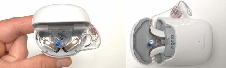 Signia Hearing Aids – Differences, Experiences, and Tech Levels ...