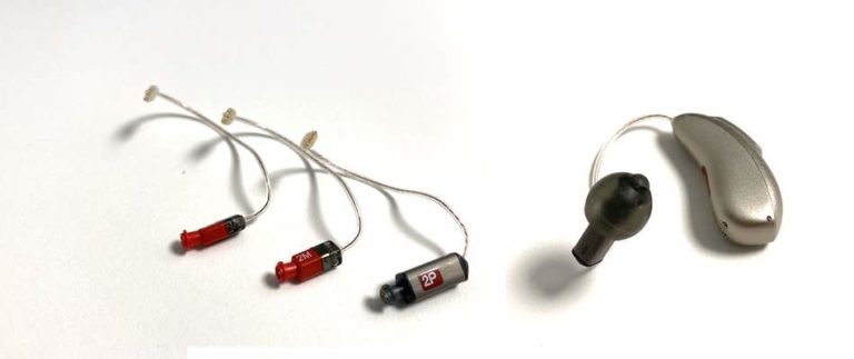 Phonak Hearing Aid Parts Diagram Parts Of A Hearing Aid Diag